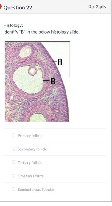 Solved Question 22 0/2 pts Histology: ldentify Solved Question 22 0/2 pts Histology: ldentify