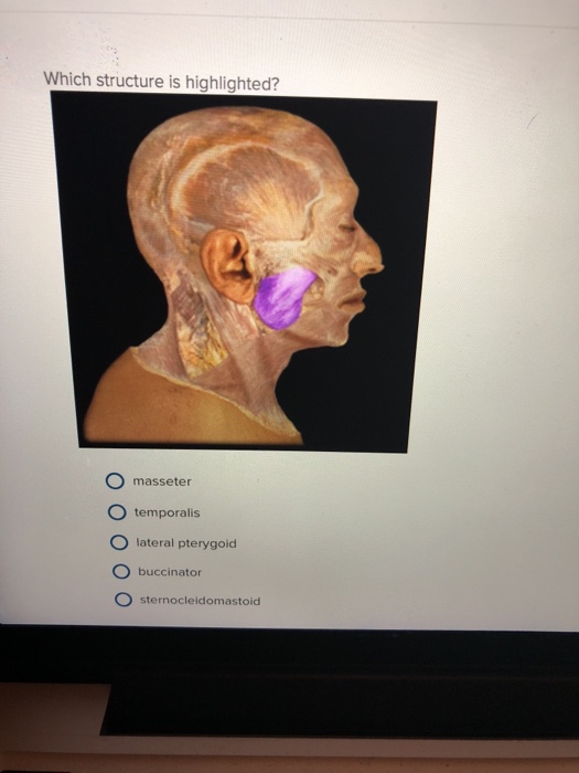 Solved Which structure is highlighted? masseter O platysma O | Chegg.com