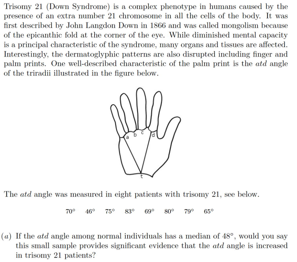 Solved Trisomy 21 (Down Syndrome) is a complex phenotype in | Chegg.com