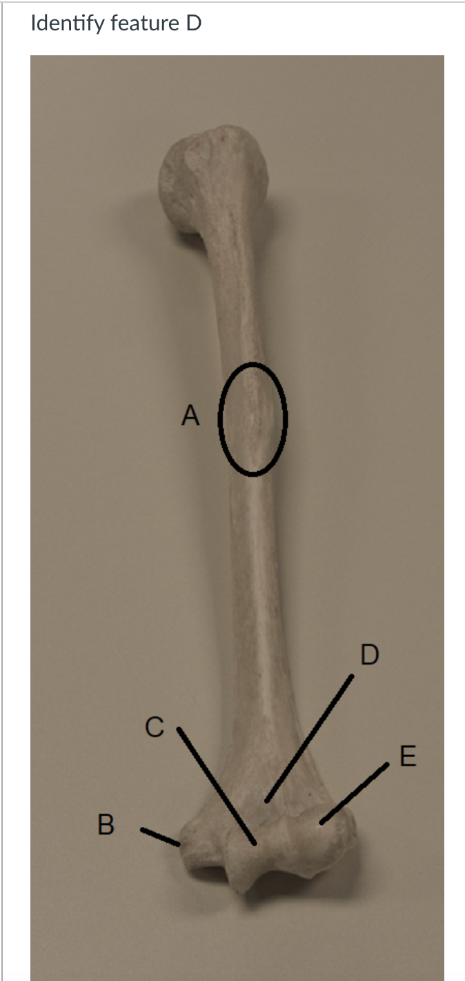 Solved Identify bone AIdentify bone FIdentify feature D | Chegg.com