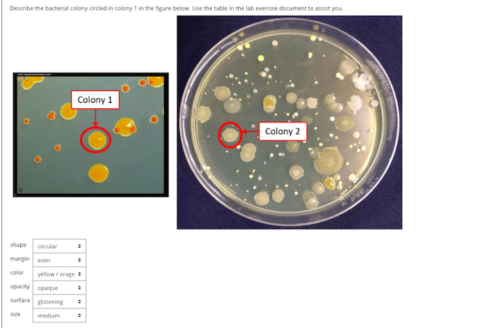Solved Describe the bacterial colony circled in colony 1 in | Chegg.com