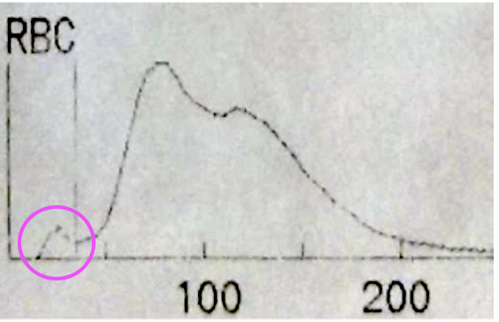 [Solved]: Interpretation of the RBC histogram. Explain why t