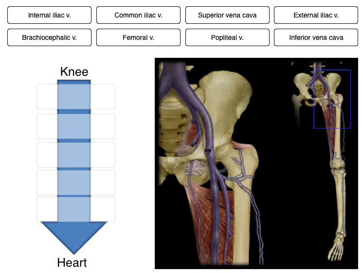 Solved Internal iliac v Common iliac v. Superior vena cava | Chegg.com