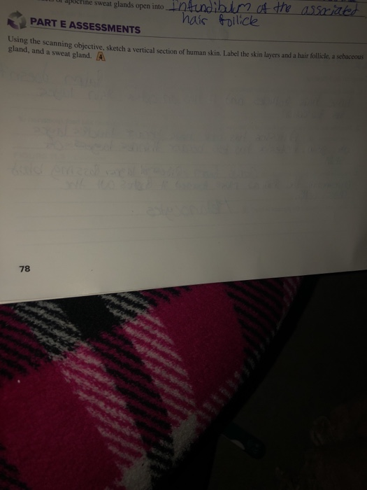 Solved apucfine sweat glands open into PART E ASSESSMENTS | Chegg.com