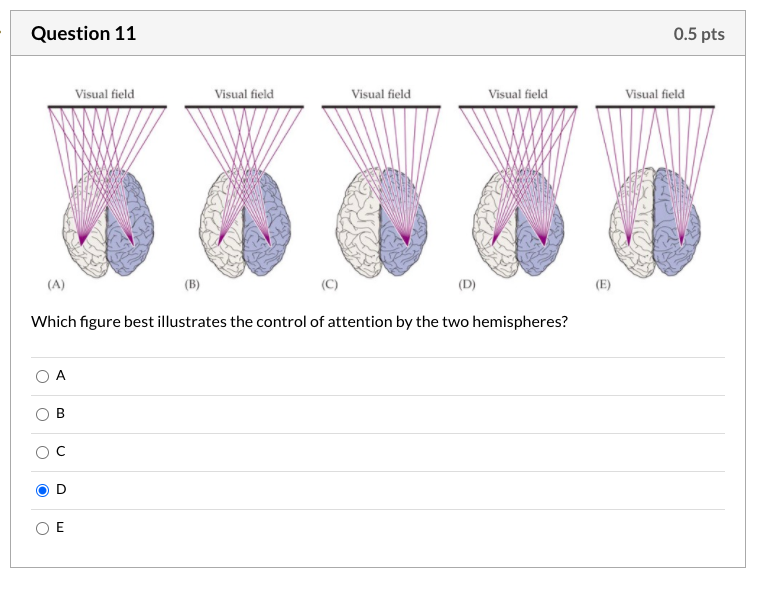Solved Question 11 0.5 pts Visual field Visual field Visual | Chegg.com