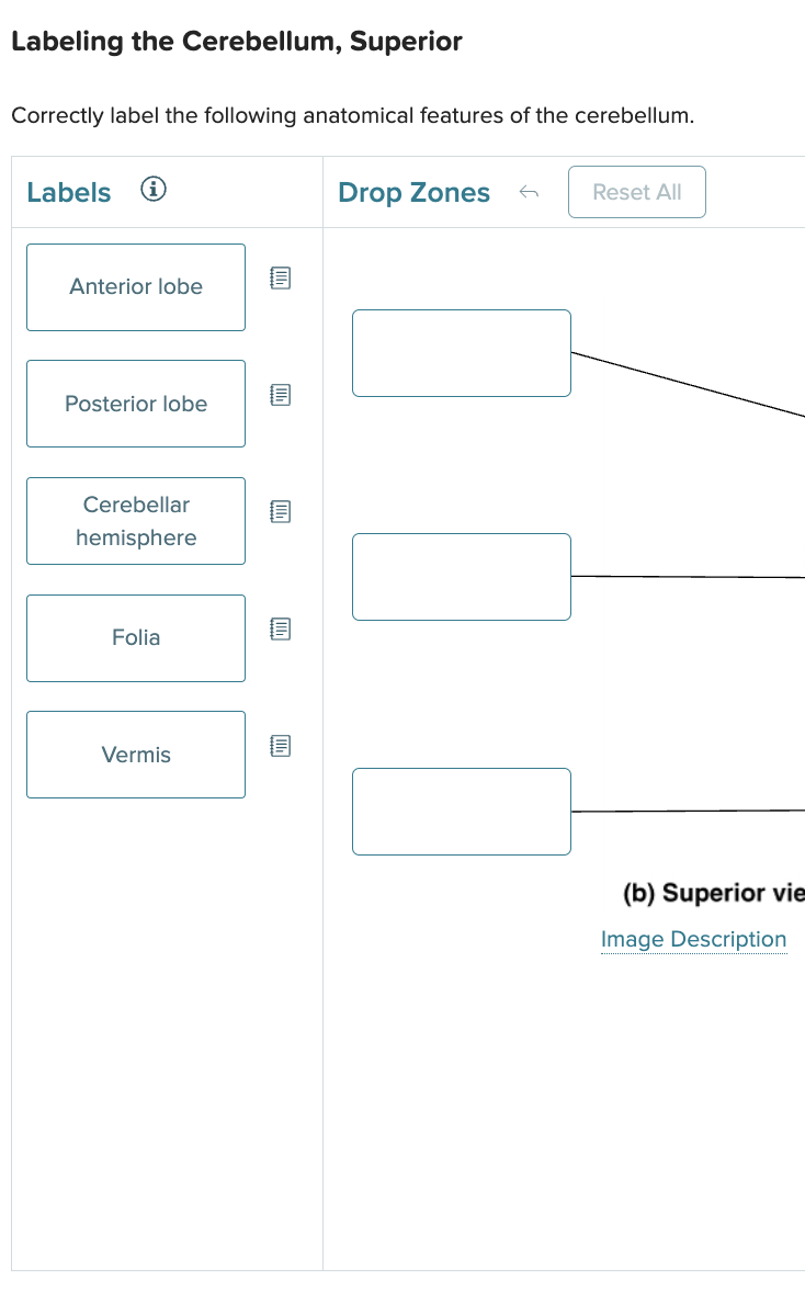 Solved Labeling the Cerebellum, SuperiorCorrectly label the | Chegg.com