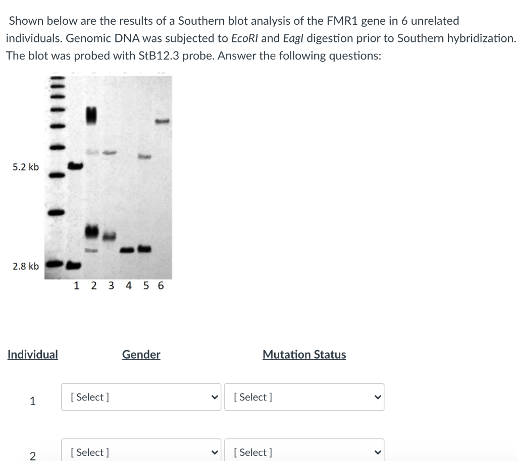 Solved Shown below are the results of a Southern blot | Chegg.com