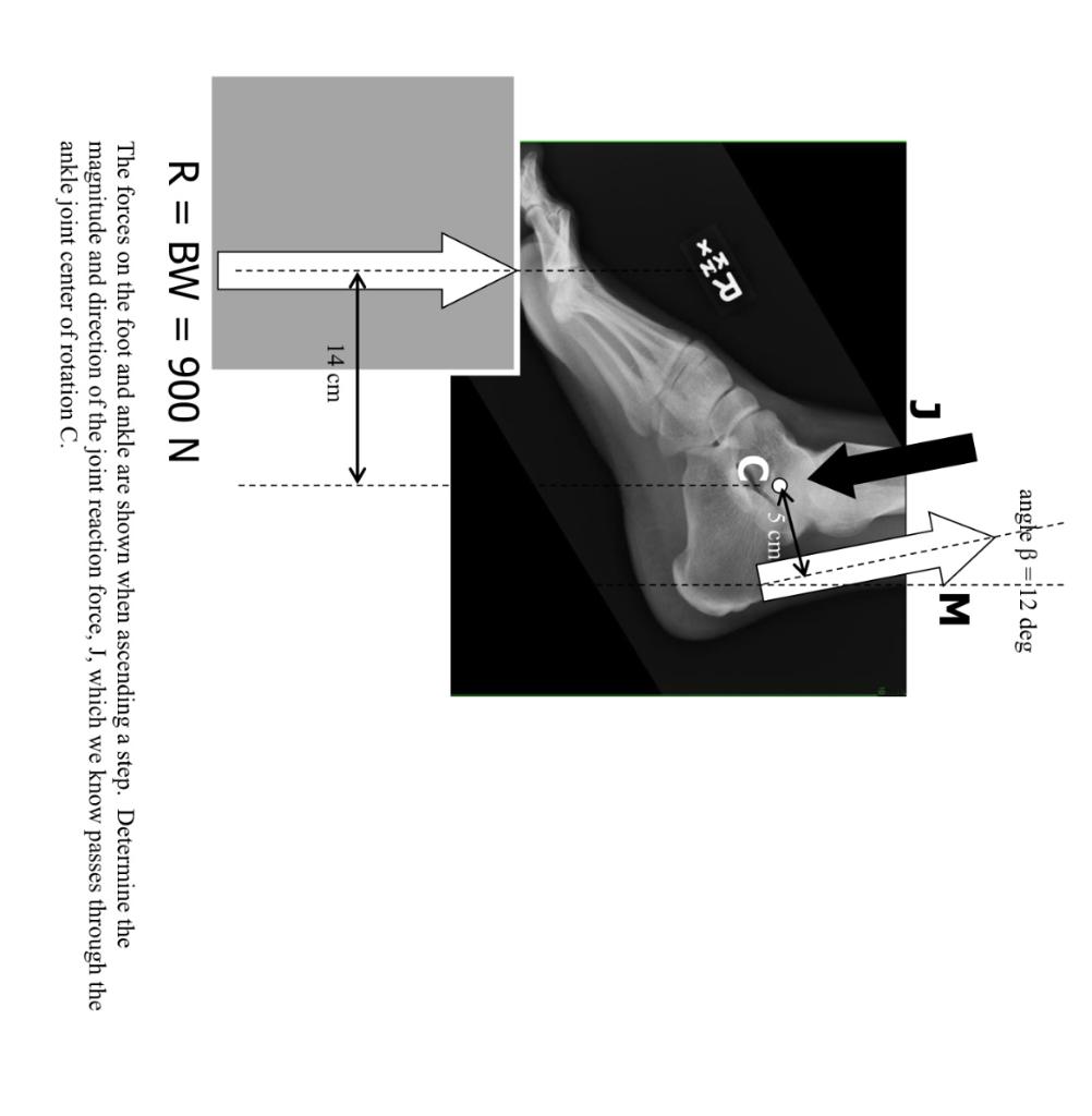 Solved The forces on the foot and ankle are shown when | Chegg.com