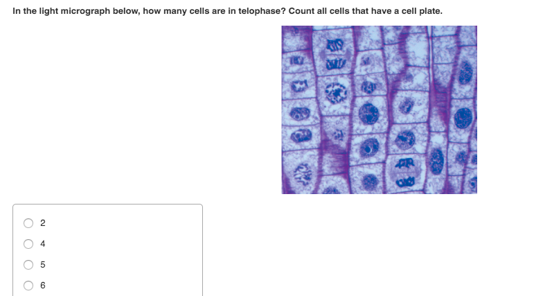 Solved In The Light Micrograph Below How Many Cells Are In Chegg solved-in-the-light-micrograph-below-how-many-cells-are-in-chegg