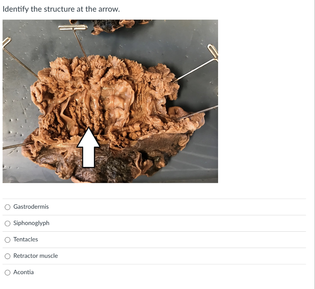 Solved Identify the structure at the arrow. Gastrodermis O | Chegg.com