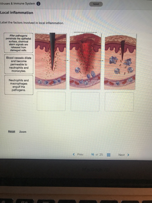 Solved Viruses & Immune System Local inflammation Label the | Chegg.com