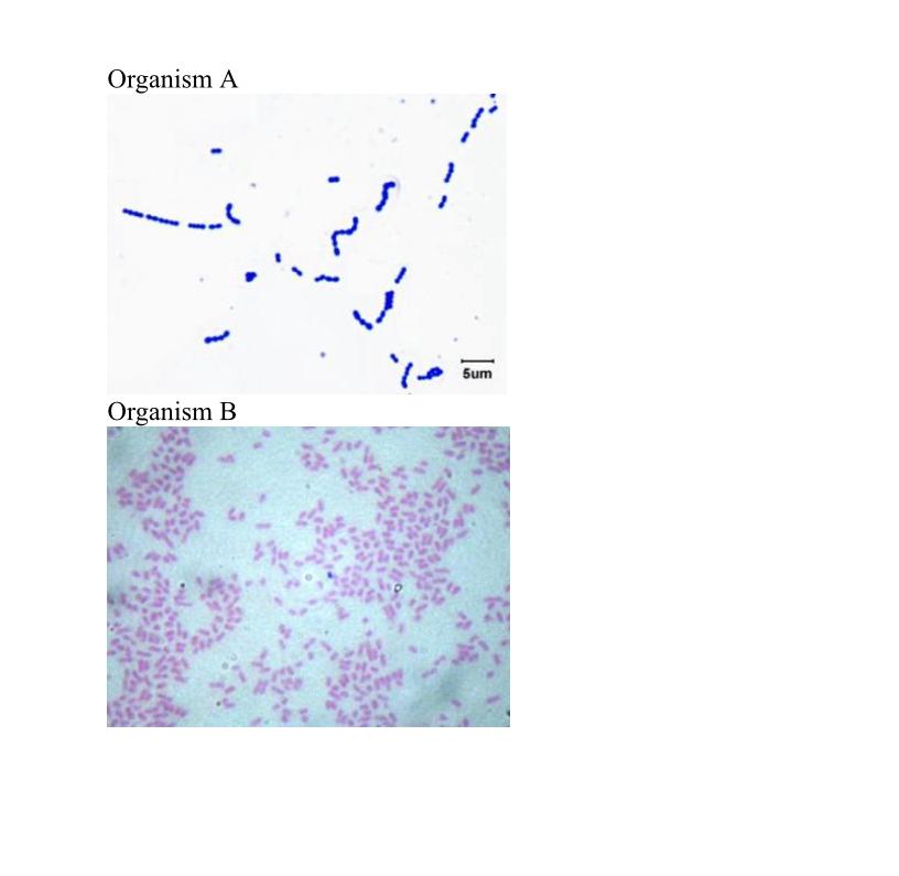You will be assigned 2 unknown organisms, one | Chegg.com