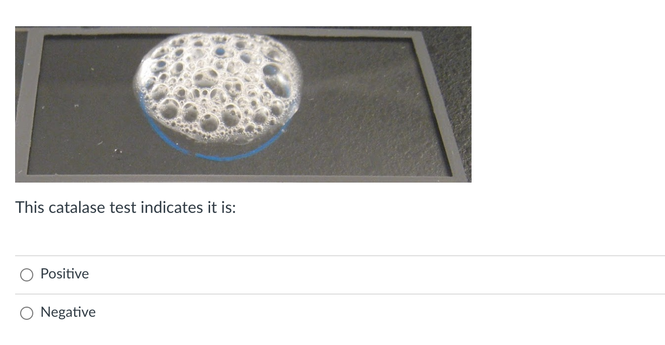 Solved This catalase test indicates it is: Positive Negative | Chegg.com