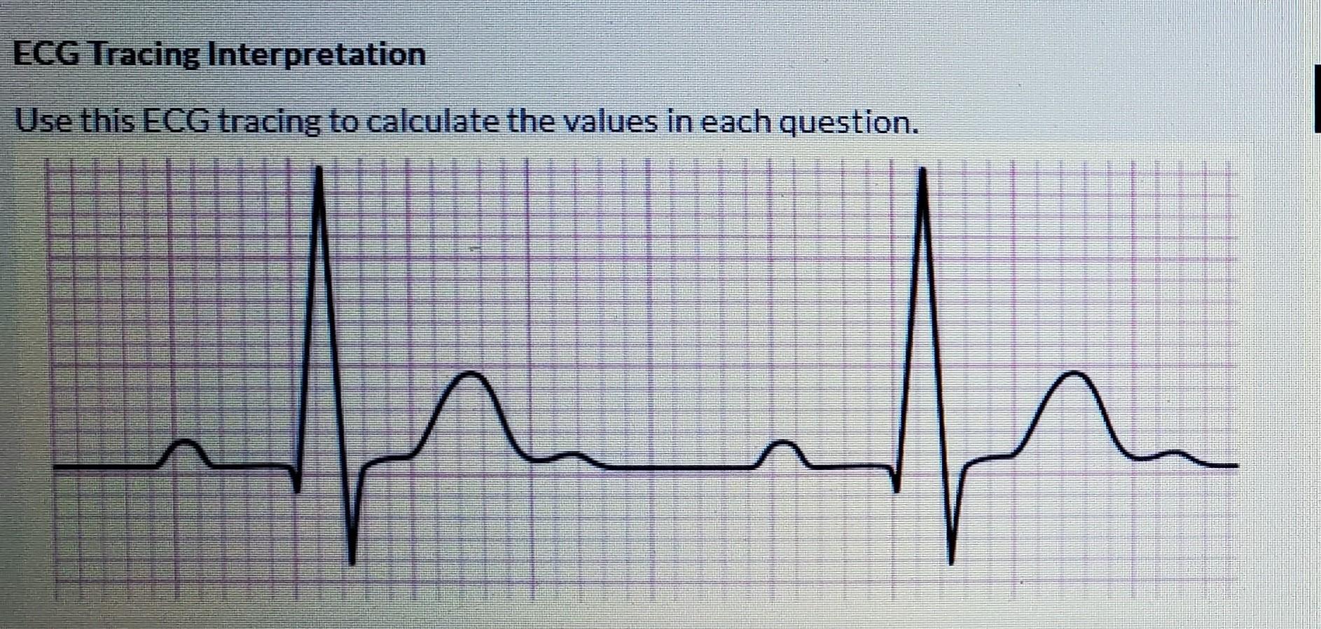 Solved ECG Tracing Interpretation Use this ECG tracing to | Chegg.com