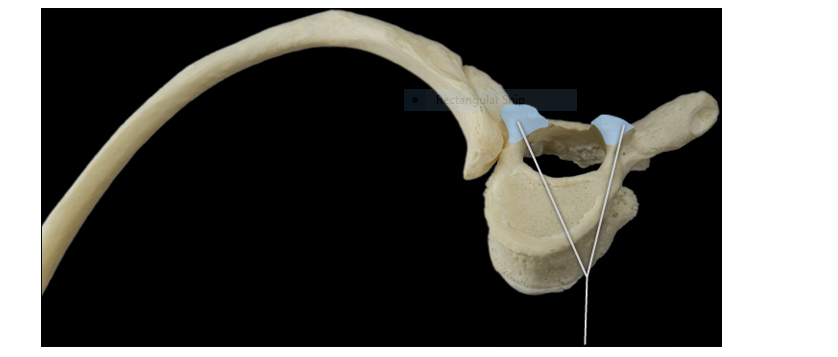 Solved Red The highlighted bone and the hip bone form what | Chegg.com