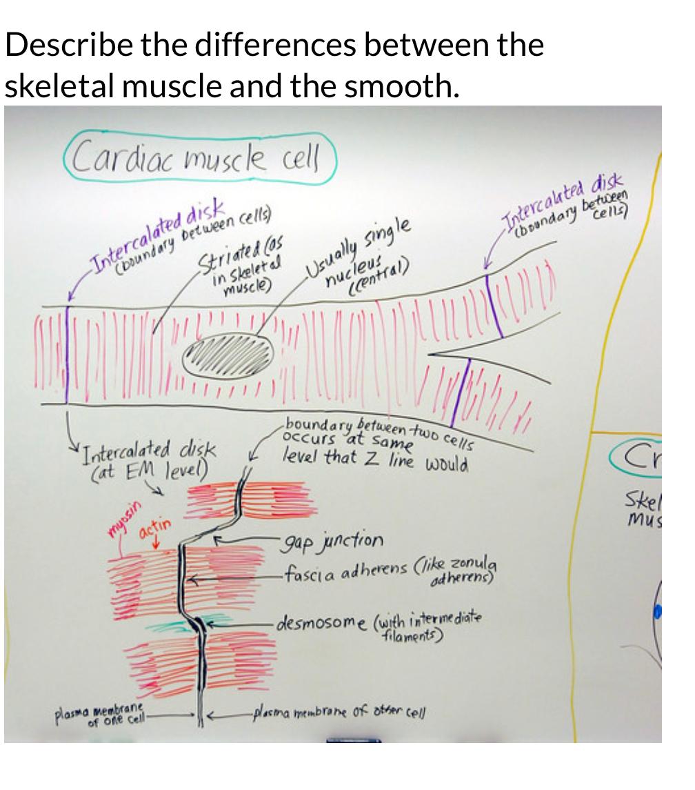 Solved Describe the differences between the skeletal muscle | Chegg.com