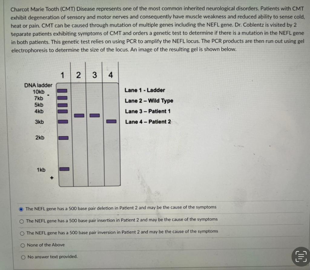 Solved Charcot Marie Tooth (CMT) Disease represents one of | Chegg.com