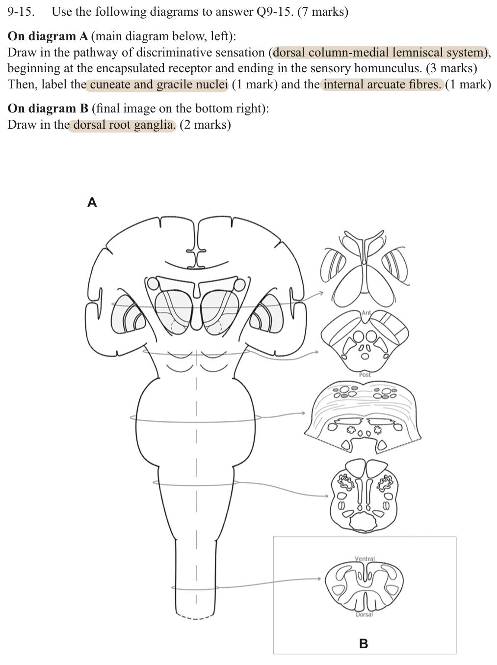 Solved 9-15. Use the following diagrams to answer Q9-15. (7 | Chegg.com