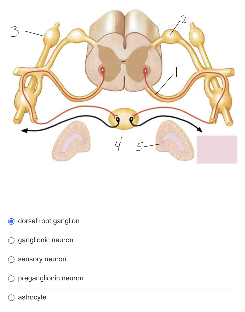 Solved 3 4 5 dorsal root ganglion O ganglionic neuron | Chegg.com