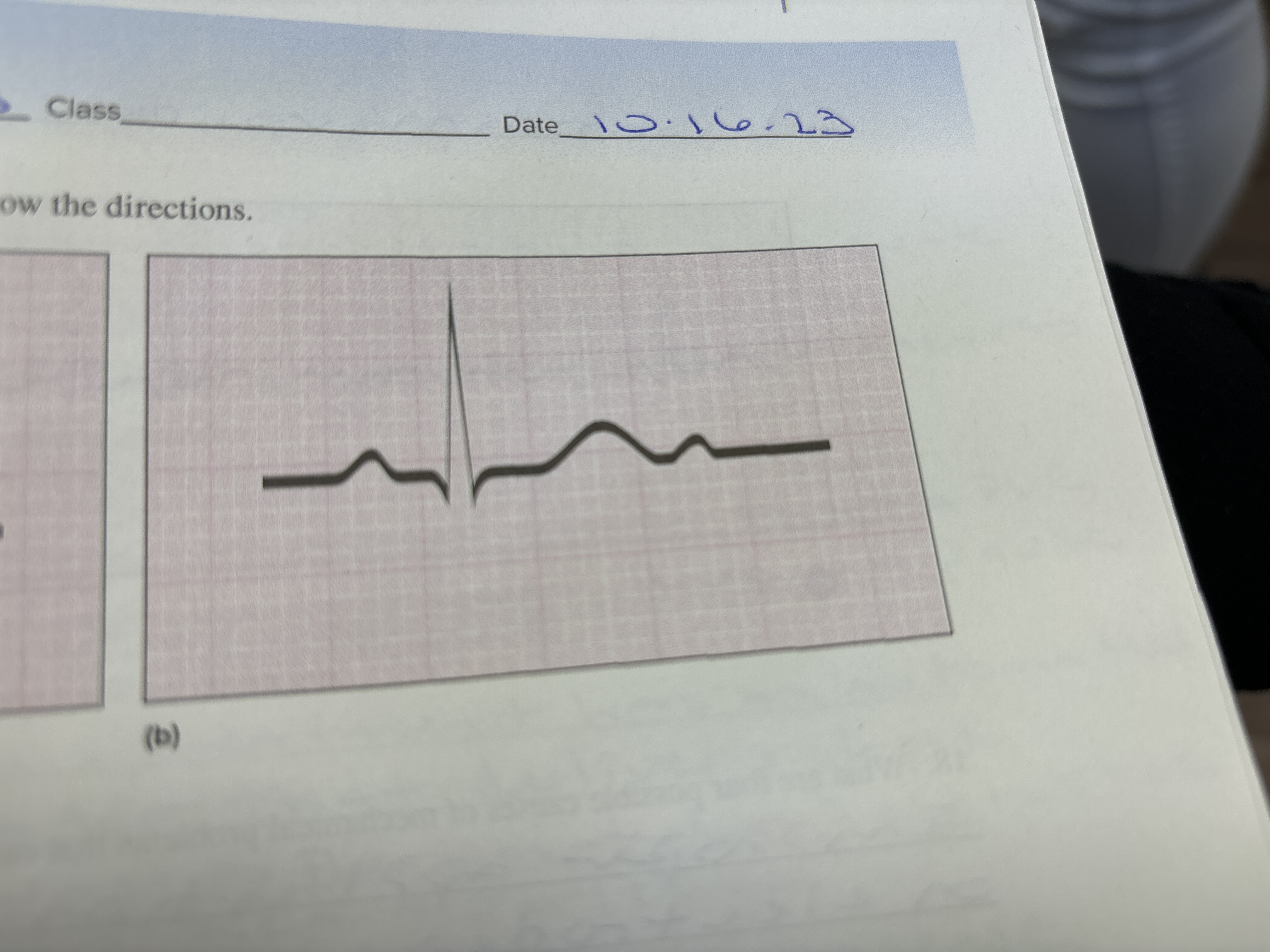 Solved On part b, draw lines and label the tracing to show | Chegg.com