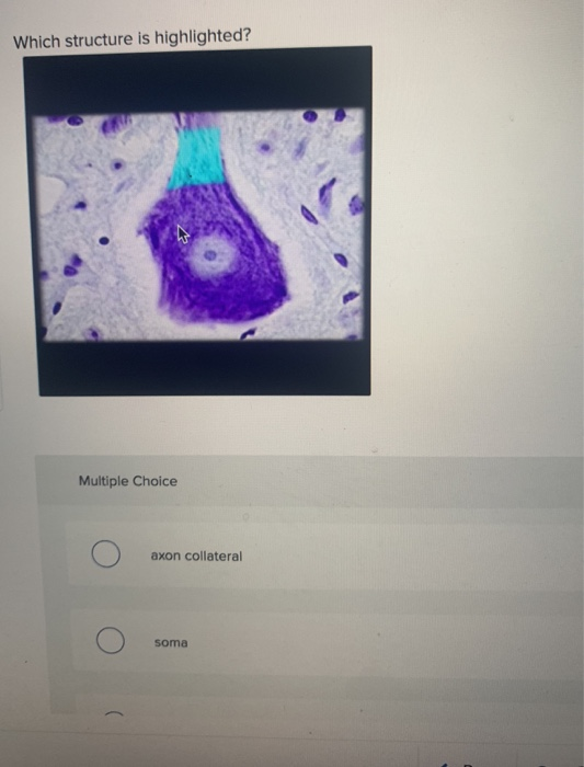 Solved Which structure is highlighted? Multiple Choice axon | Chegg.com