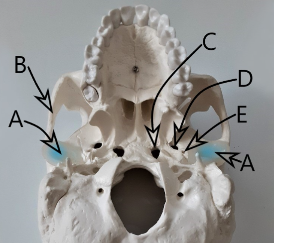 Solved 1.The projection "A" is [ Select ] ["zygomatic | Chegg.com
