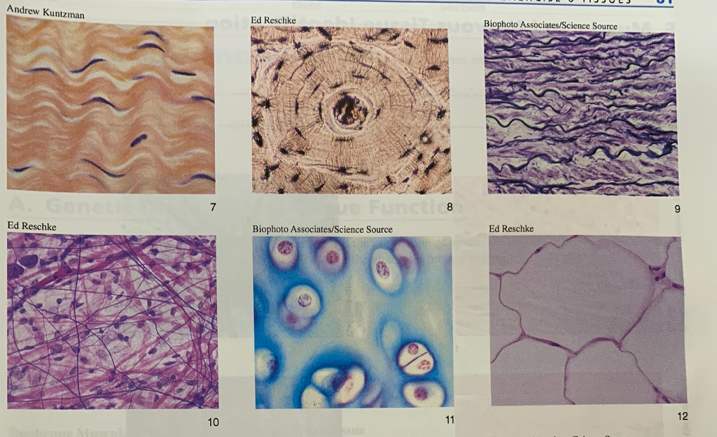Solved Identify the epithelia (1 -6) and connective tissue | Chegg.com