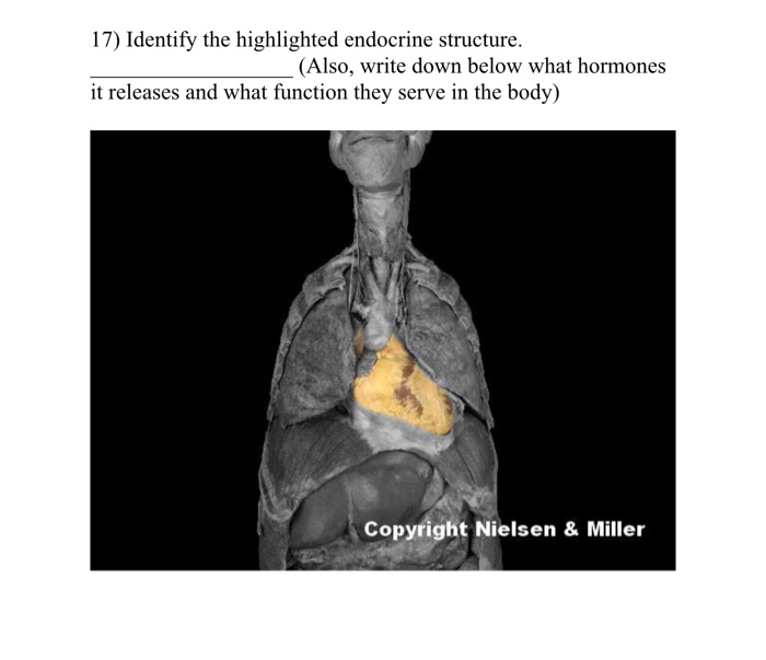 Solved 17) Identify the highlighted endocrine structure. | Chegg.com