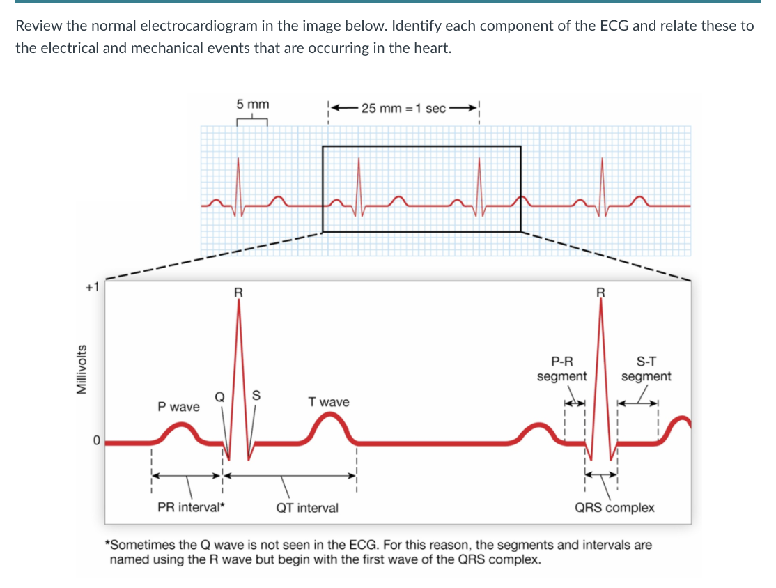 Solved Review the normal electrocardiogram in the image | Chegg.com