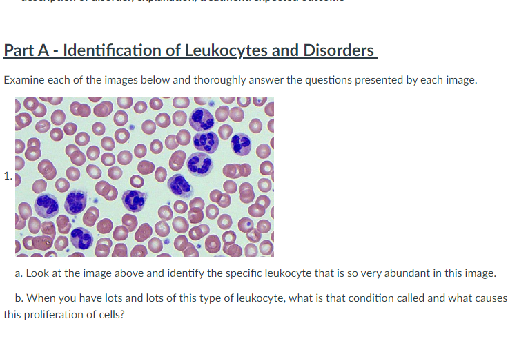 Solved Part A - Identification of Leukocytes and Disorders | Chegg.com