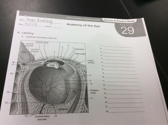 Solved Review & Practice Sheet 29 Anatomy of the Eye A. | Chegg.com