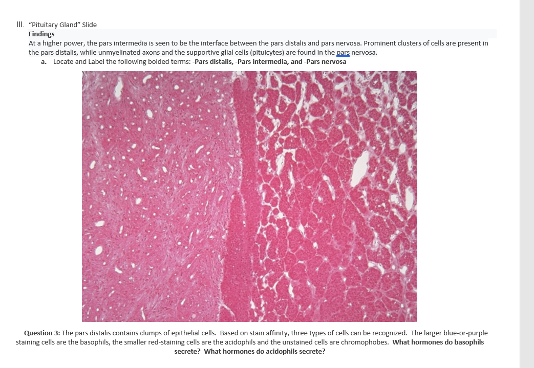 Solved III. "Pituitary Gland" Slide Findings At a higher | Chegg.com