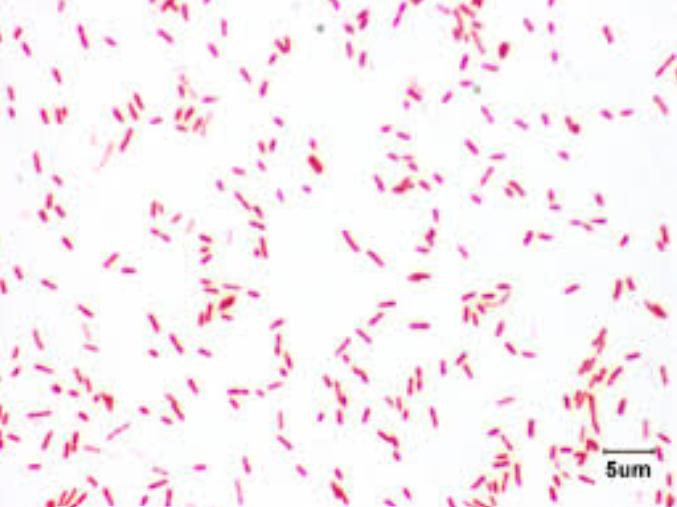 Solved I need help identifying the ID of this bacterial | Chegg.com