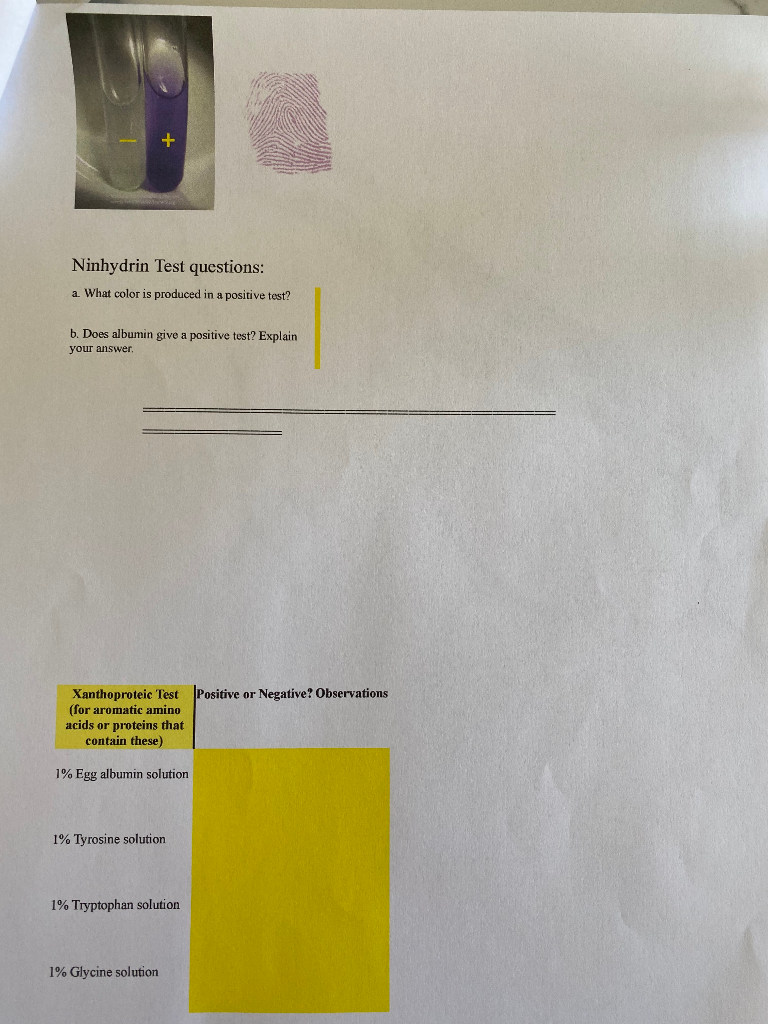 Solved Ninhydrin Test questions: a. What color is produced | Chegg.com