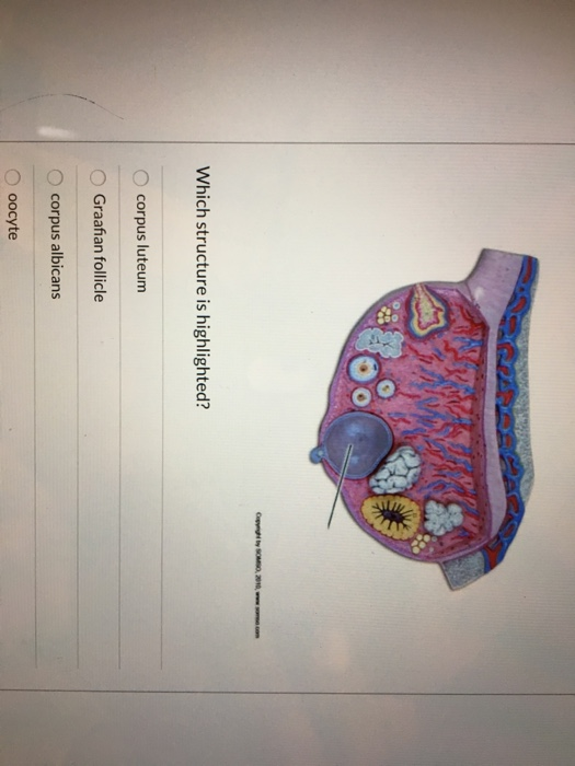 Solved Which structure is highlighted? corpus luteum | Chegg.com