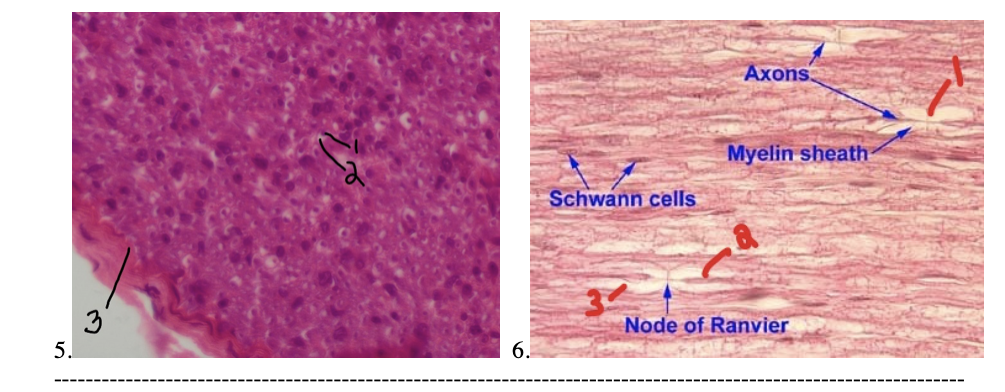 Teased Myelinated Nerve Fiber Slide