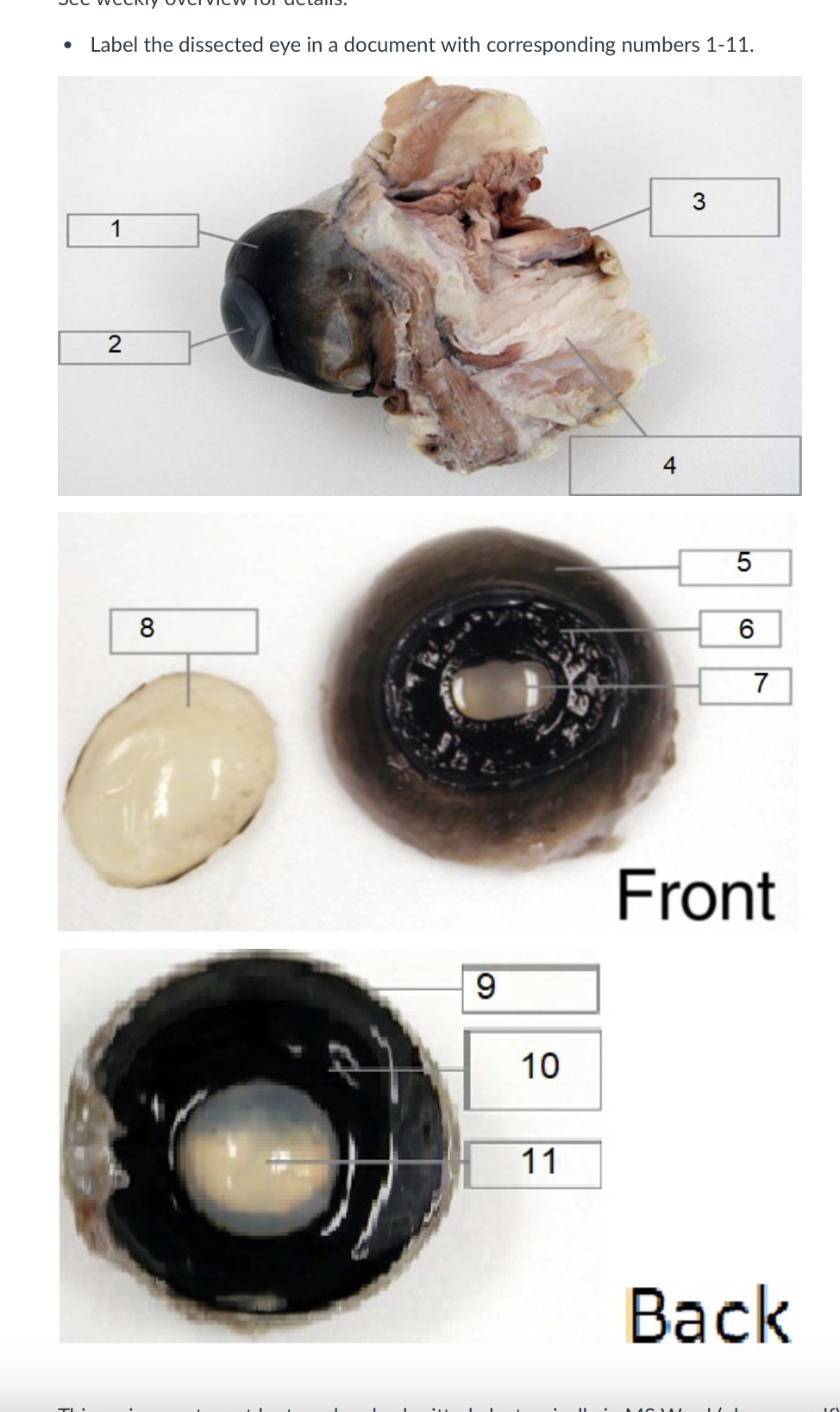 Solved - ﻿Label the dissected eye in a document with | Chegg.com