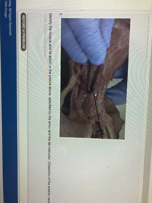 Solved 3. Identify the muscle and its action in the picture | Chegg.com
