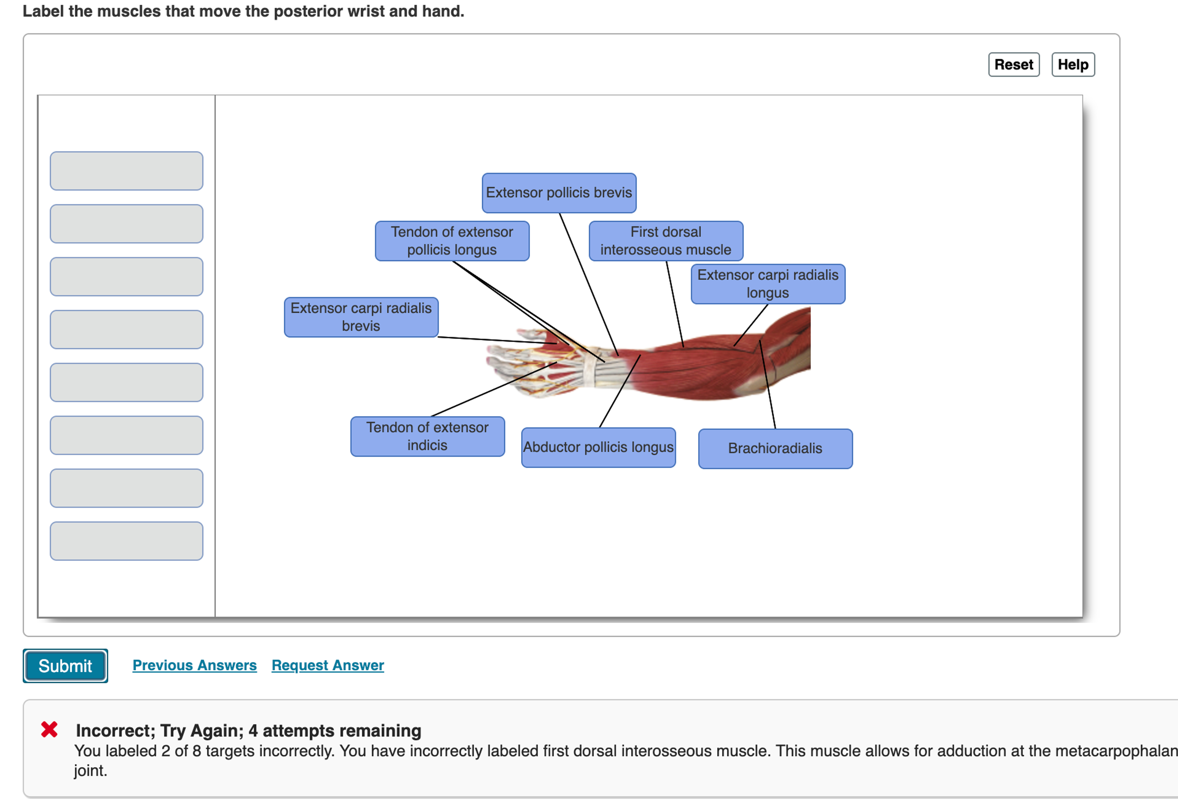 Solved Label the muscles that move the posterior wrist and | Chegg.com