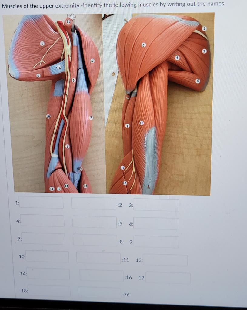 Solved Muscles of the upper extremity -Identify the | Chegg.com