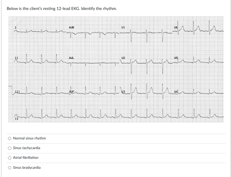 Solved Below is the client's resting 12-lead EKG. Identify | Chegg.com