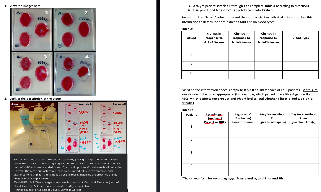 Solved 1) Look this blood testing experiment and fill the | Chegg.com