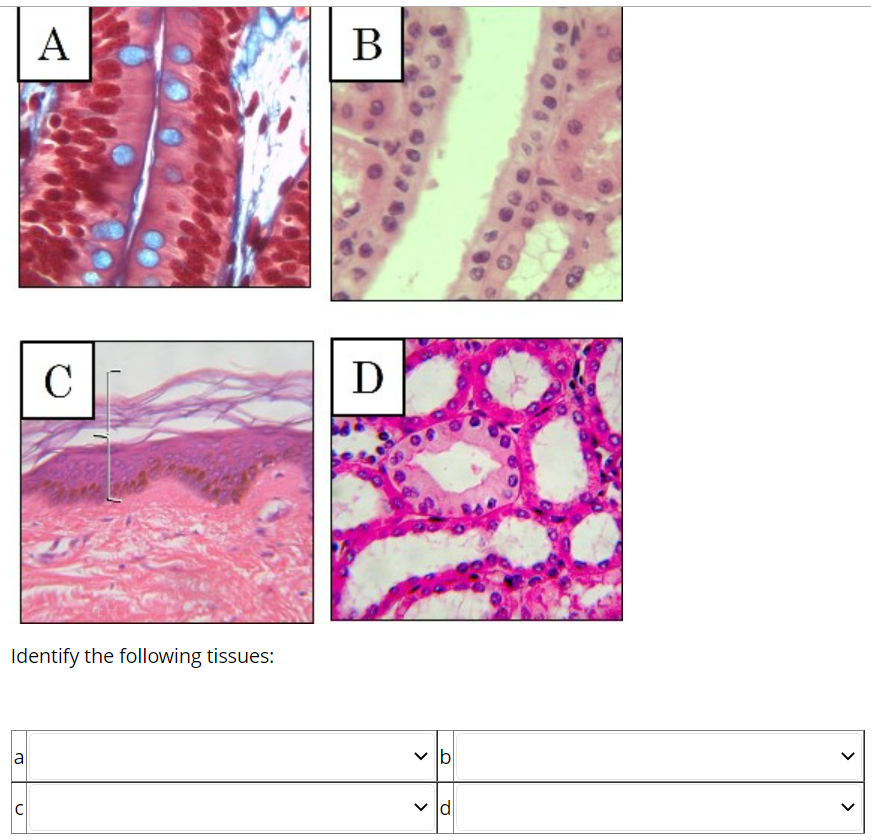 Solved A В. C D Identify the following tissues: a vb > с vd | Chegg.com