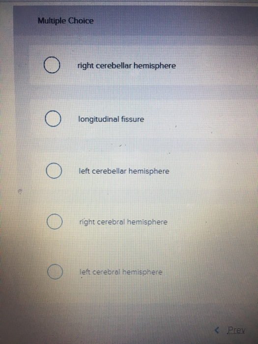 Solved Which structure is highlighted? Multiple Choice | Chegg.com
