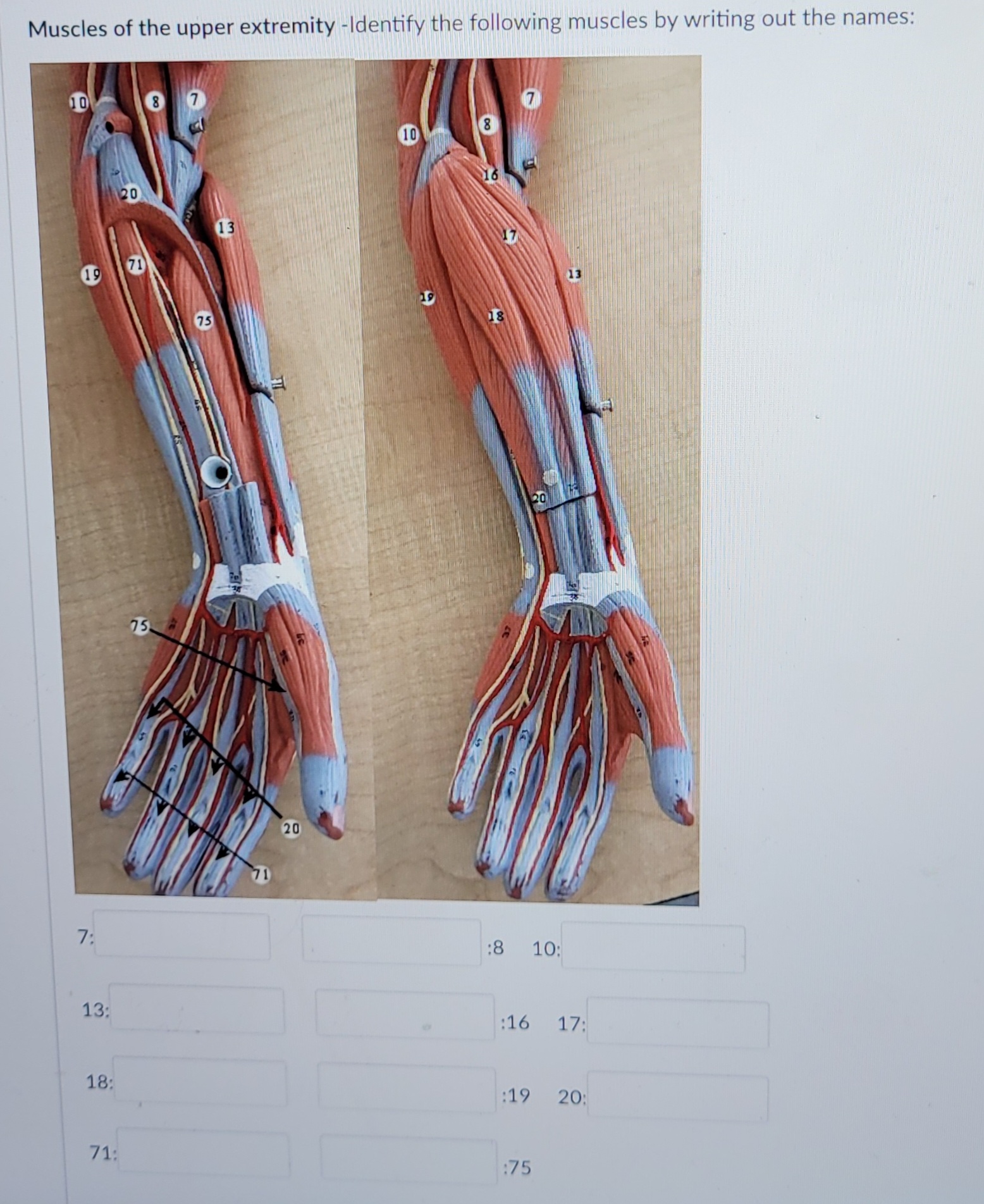 Solved Muscles of the upper extremity -Identify the | Chegg.com