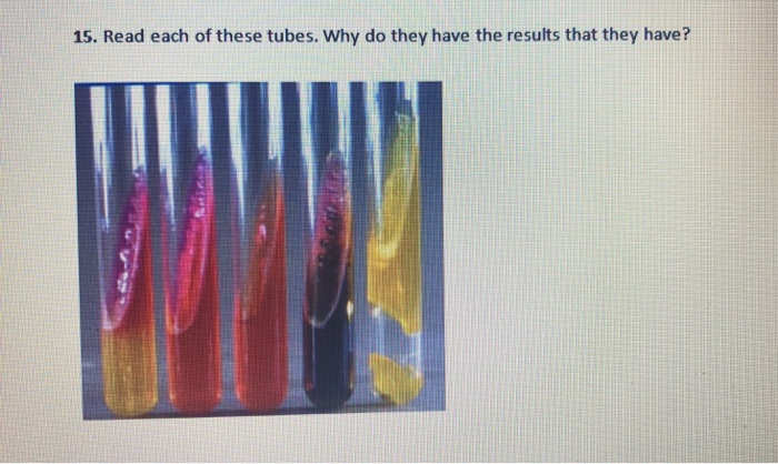 Solved 13. Which bacteria in this agar are lactose | Chegg.com