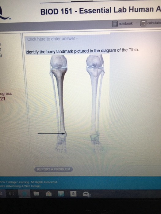 Solved BIOD 151 Essential Lab Human Anat Identify the bony | Chegg.com