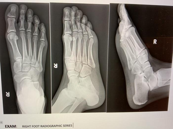 Solved R \& y EXAM: RIGHT FOOT RADIOGRAPHIC SERIES] | Chegg.com