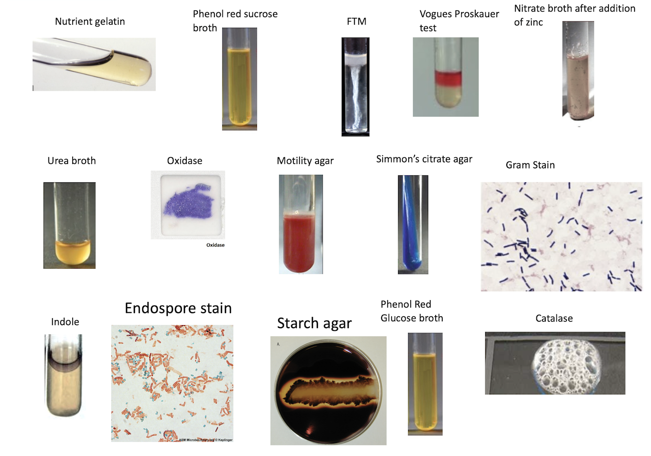 Solved Phenol red sucrose broth Nutrient gelatin Nitrate | Chegg.com