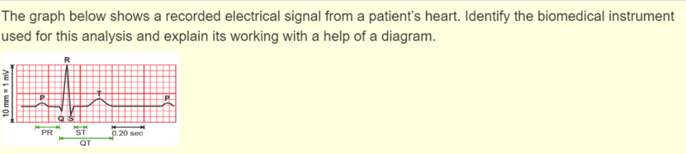 Solved The graph below shows a recorded electrical signal | Chegg.com